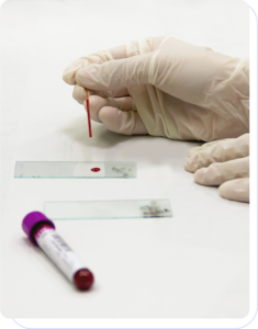 Hemophobia (Fear of Blood): Risk Factors and Treatment - MEDvidi